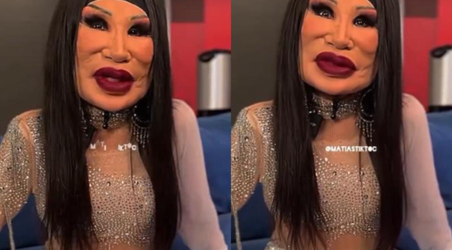 ¿Qué le pasó? Viralizan video de Lyn May con la cabeza hinchada - Hoy ...